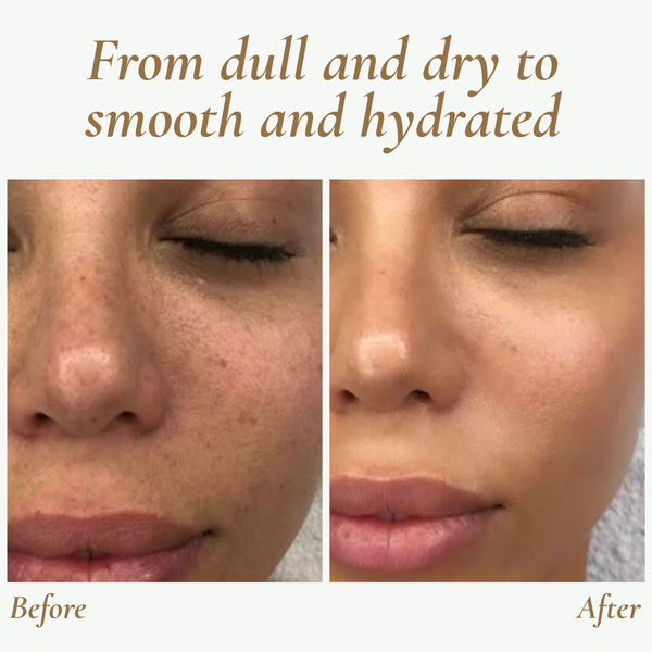 SkinPulse™ - Professional Ultrasonic Skin Cleansing