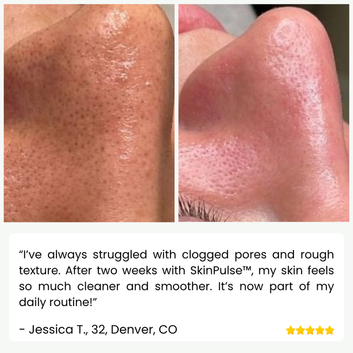 SkinPulse™ - Professional Ultrasonic Skin Cleansing